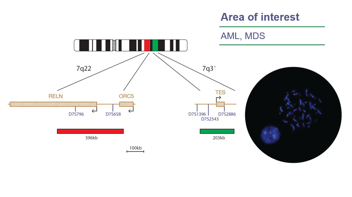 CytoCell FDA-cleared FISH probes for AML & MDS | OGT
