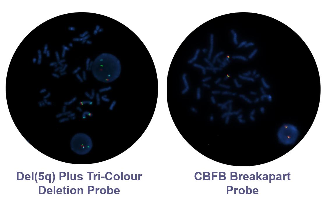 OGT - Pioneers in hybridisation technology