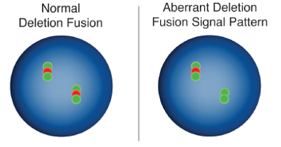 Common FISH signal patterns | OGT