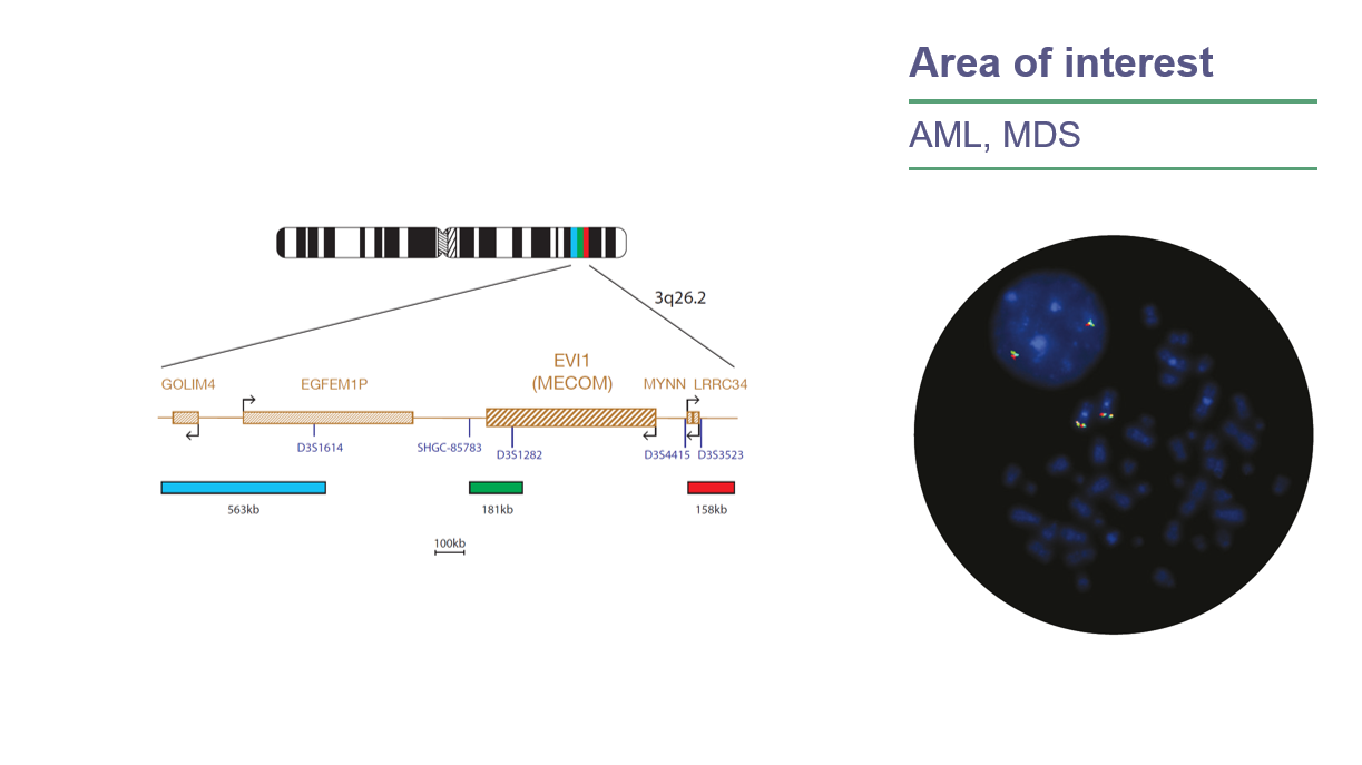 CytoCell IVDR FISH probes | OGT