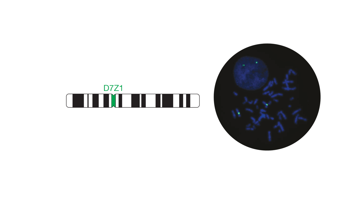 CytoCell fluorescence in situ hybridization (FISH) | OGT