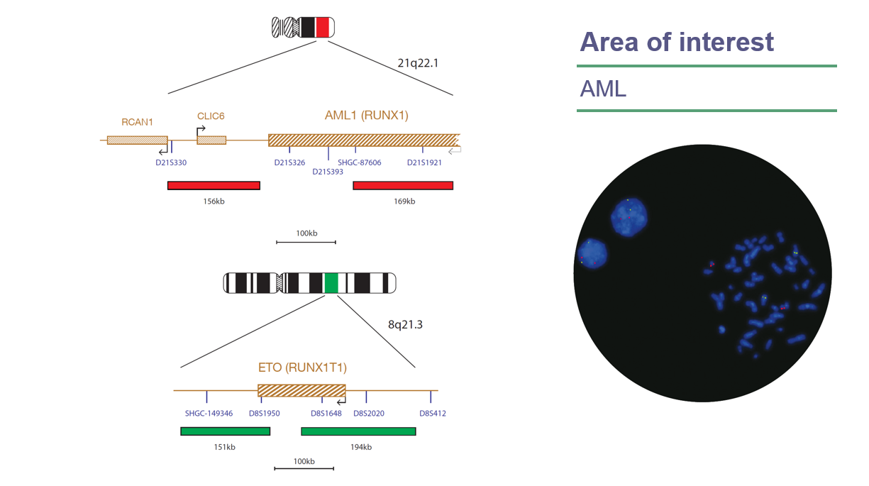 CytoCell AML1/ETO (RUNX1/RUNX1T1) FISH Probe | OGT