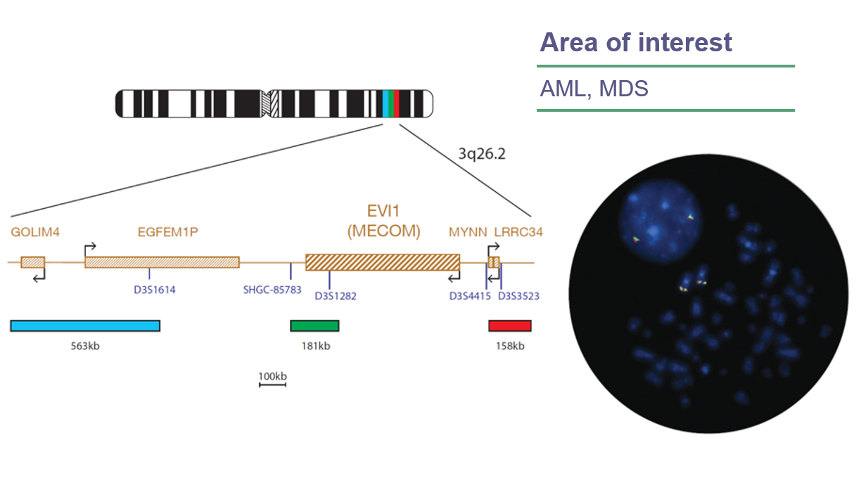 CytoCell FDA-cleared FISH probes for AML & MDS | OGT