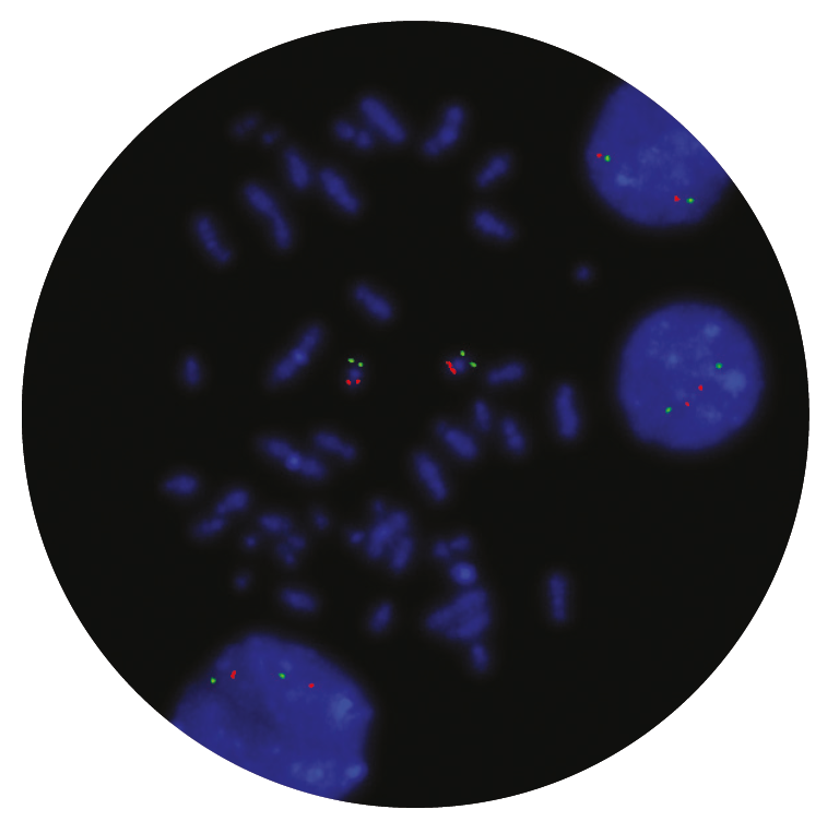 CytoCell CBFβ (CBFB)/MYH11 Translocation FISH Probe