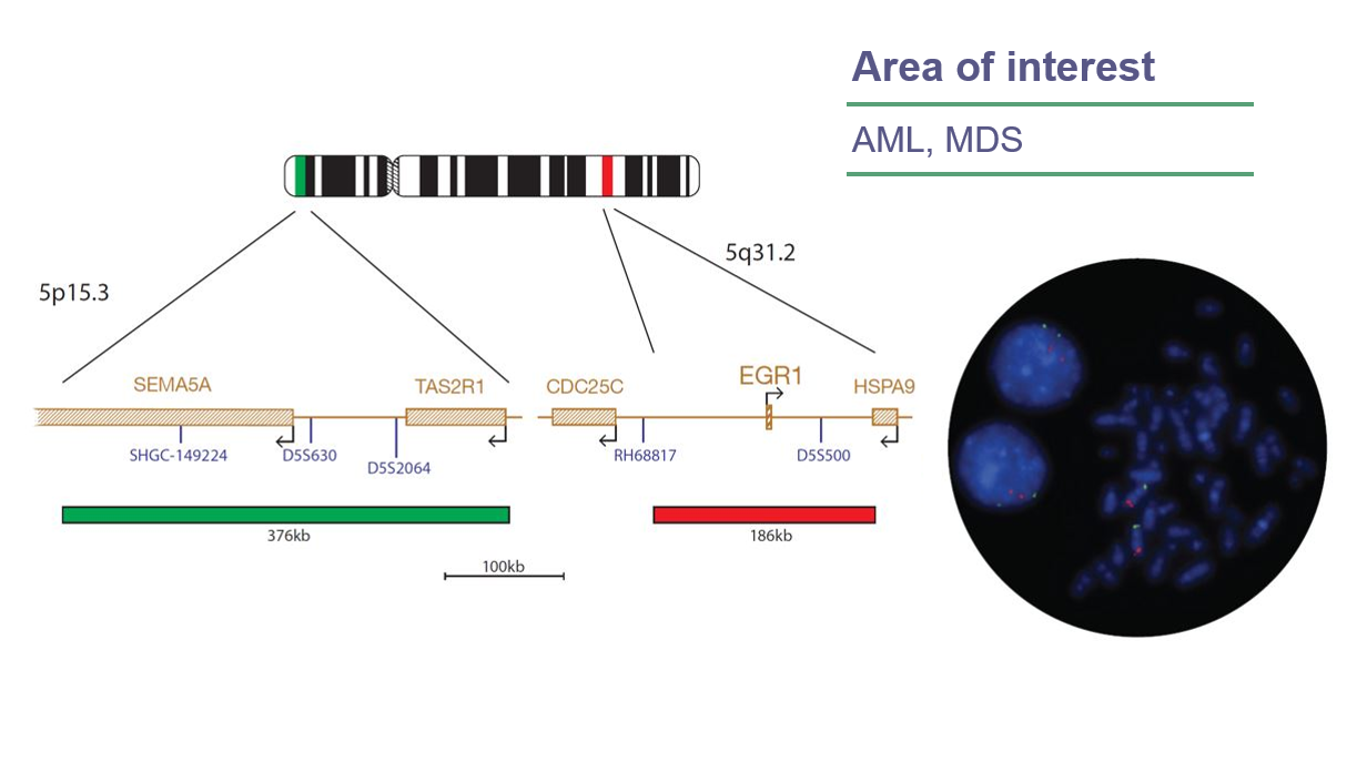 CytoCell FDA-cleared FISH probes for AML & MDS | OGT