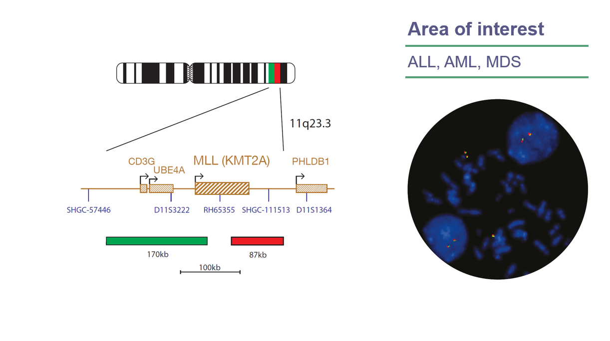 CytoCell MLL (KMT2A) Breakapart FISH Probe | OGT