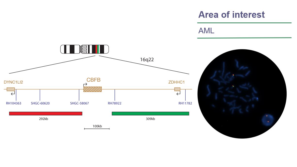 CytoCell CBFB Breakapart FISH Probe | OGT