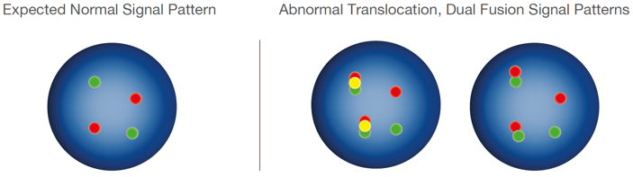 Common FISH signal patterns | OGT