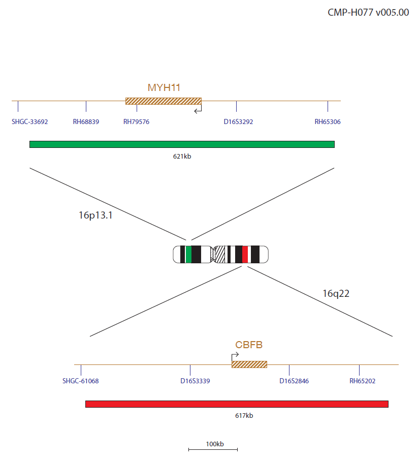 CytoCell CBFβ (CBFB)/MYH11 Translocation FISH Probe