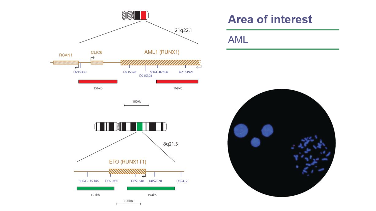 CytoCell FDA-cleared FISH probes for AML & MDS | OGT